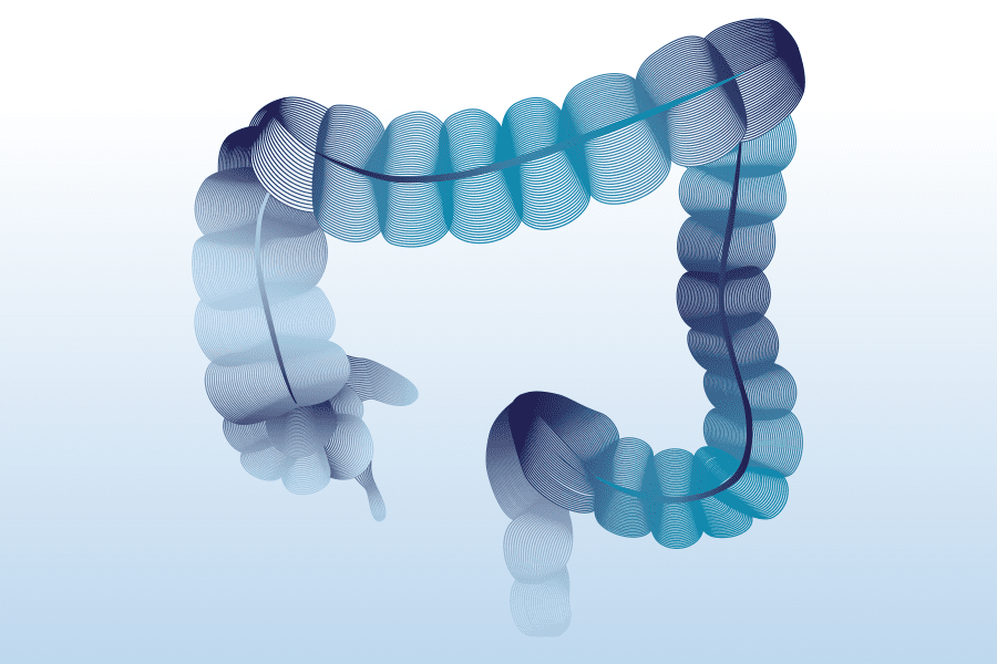 Direct Access Colonoscopy – Mid North Coast Local Health District ...